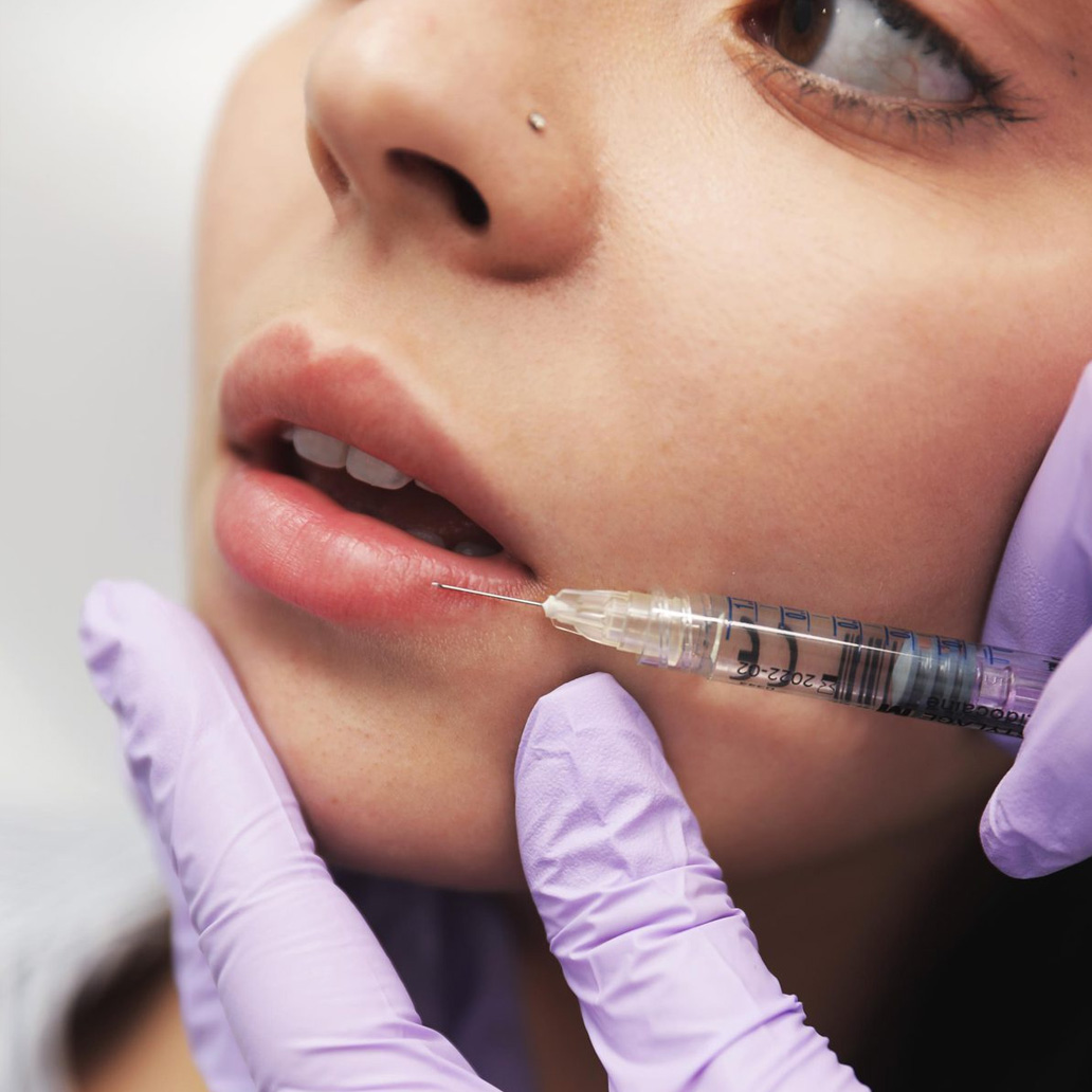 Dermal Fillers - The One Clinic