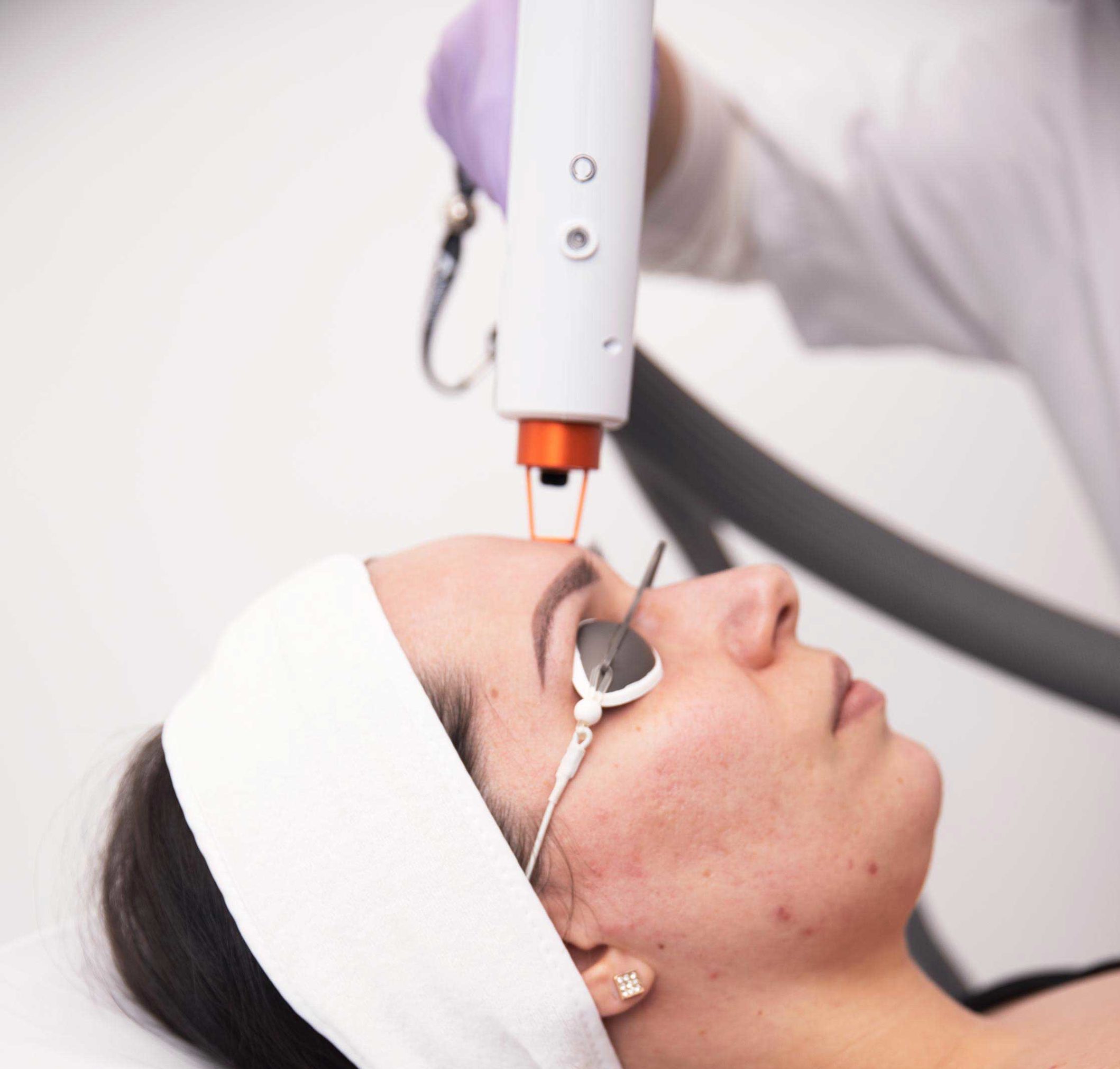 Laser Treatments - The One Clinic