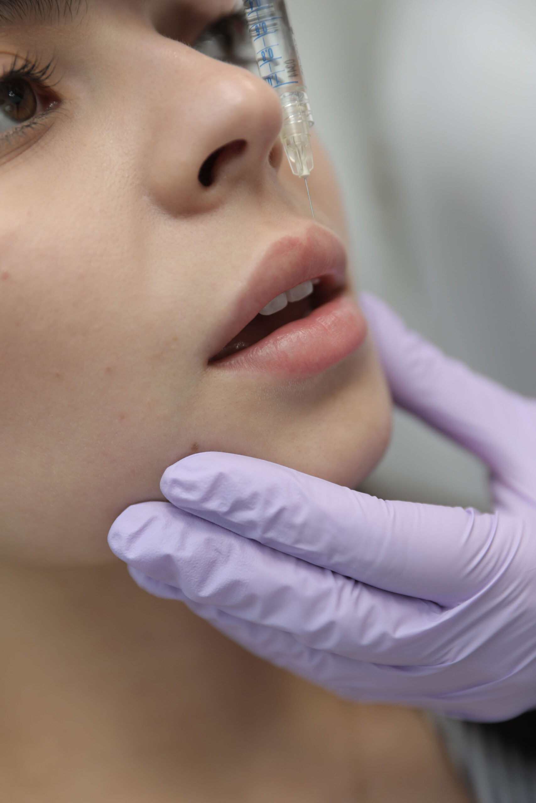 Dermal Fillers - The One Clinic